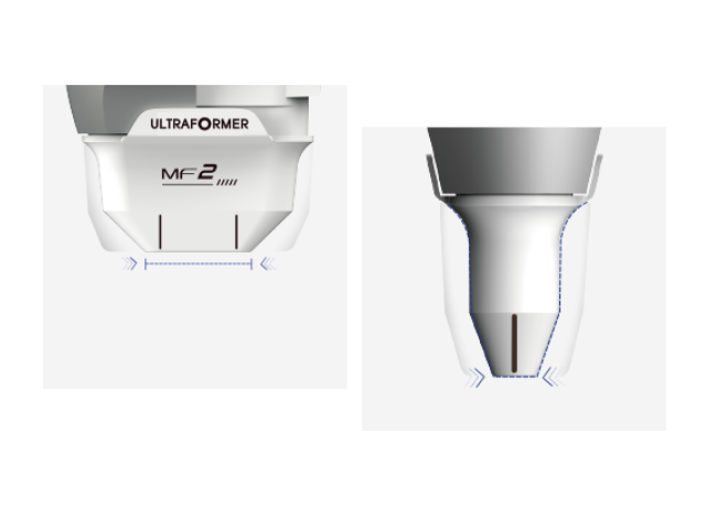 ULTRAFORMER lll - CLASSYS