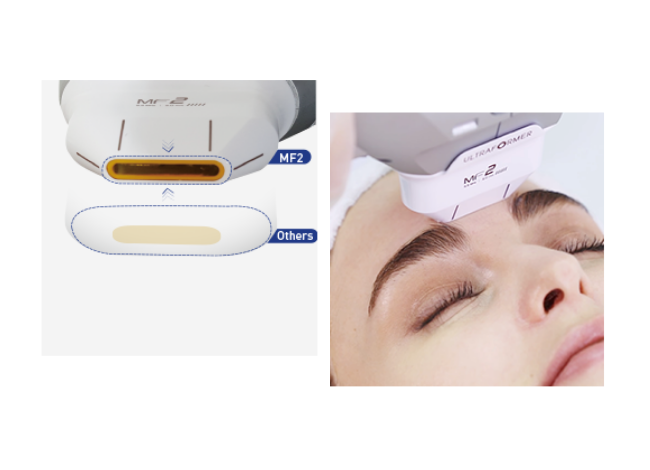 ULTRAFORMER lll - CLASSYS