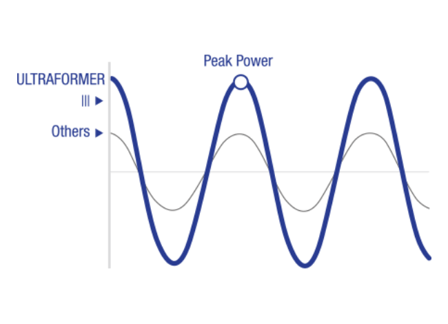 ULTRAFORMER lll - CLASSYS