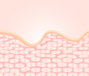 ULTRAFORMER lll - CLASSYS